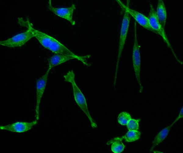 MC38 Murine Colon Adenocarcinoma Cell Line | SCC172